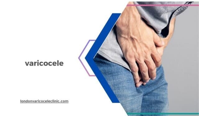 Understanding Varicocele Causes Symptoms And Treatment Options